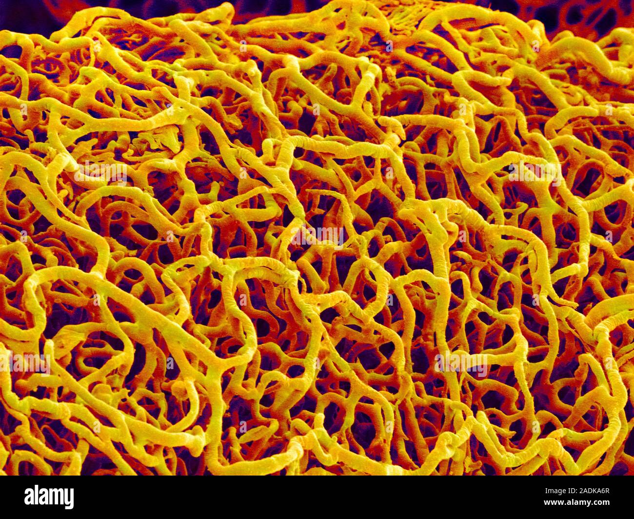 Blood vessels from the colon (large intestine), coloured scanning ...
