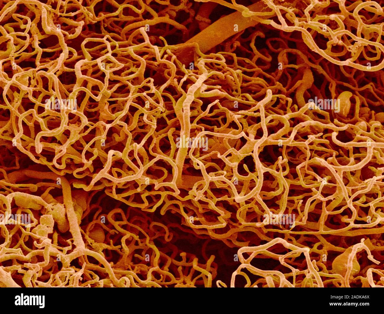 Blood vessels from the pancreas, coloured scanning electron micrograph ...