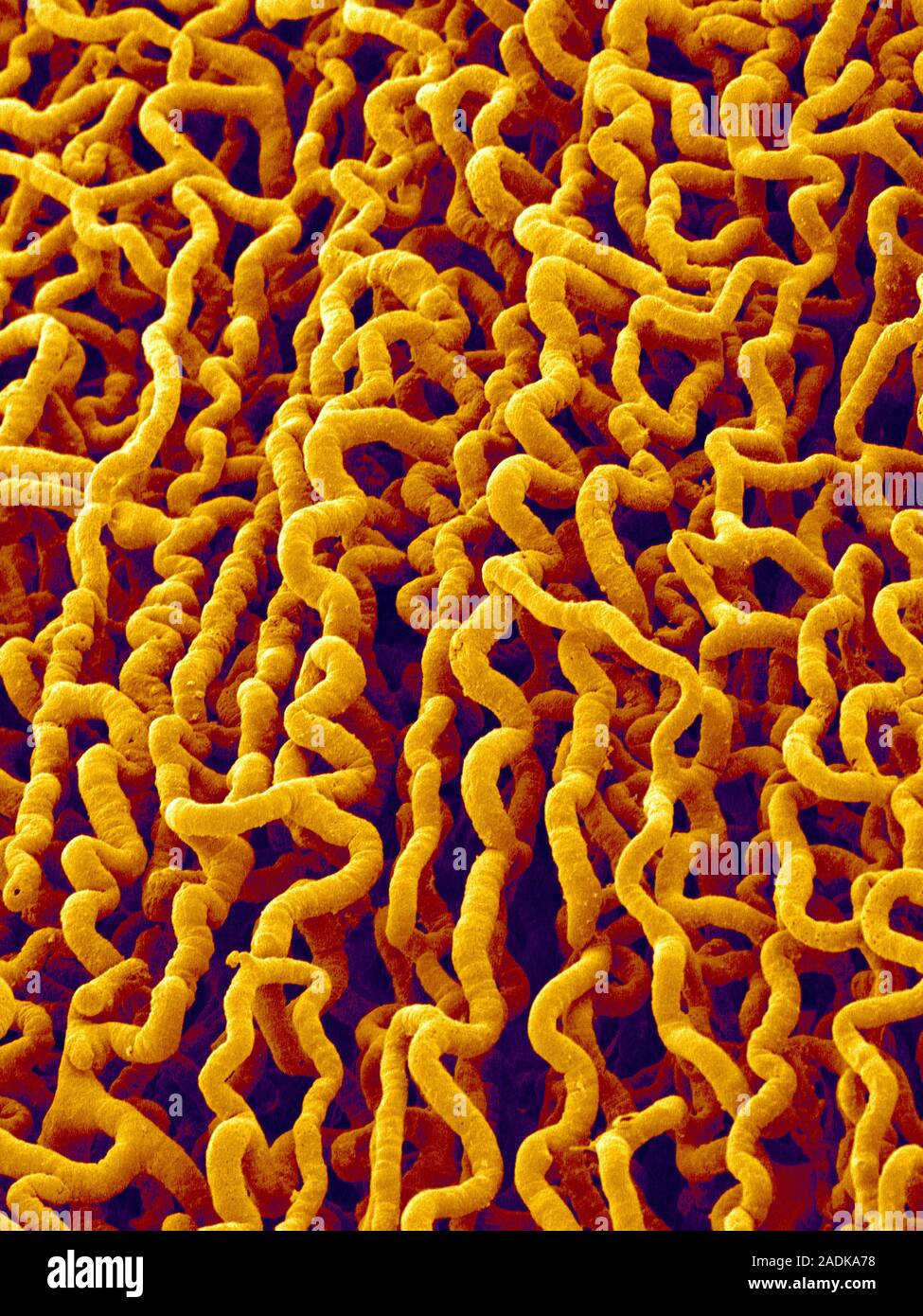 Blood vessels from skeletal muscle, coloured scanning electron ...