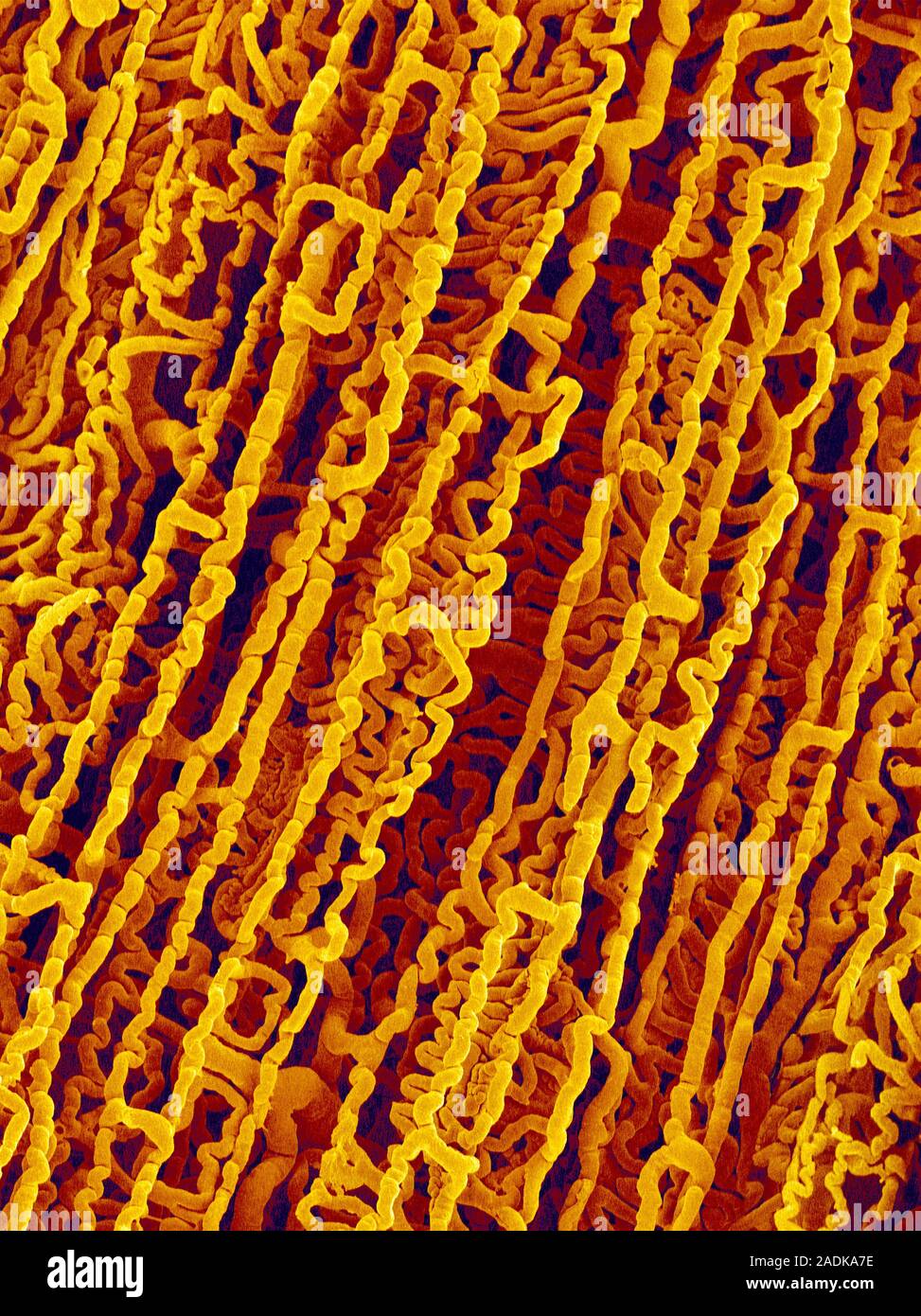 Blood vessels from skeletal muscle, coloured scanning electron micrograph (SEM). Skeletal, or ...