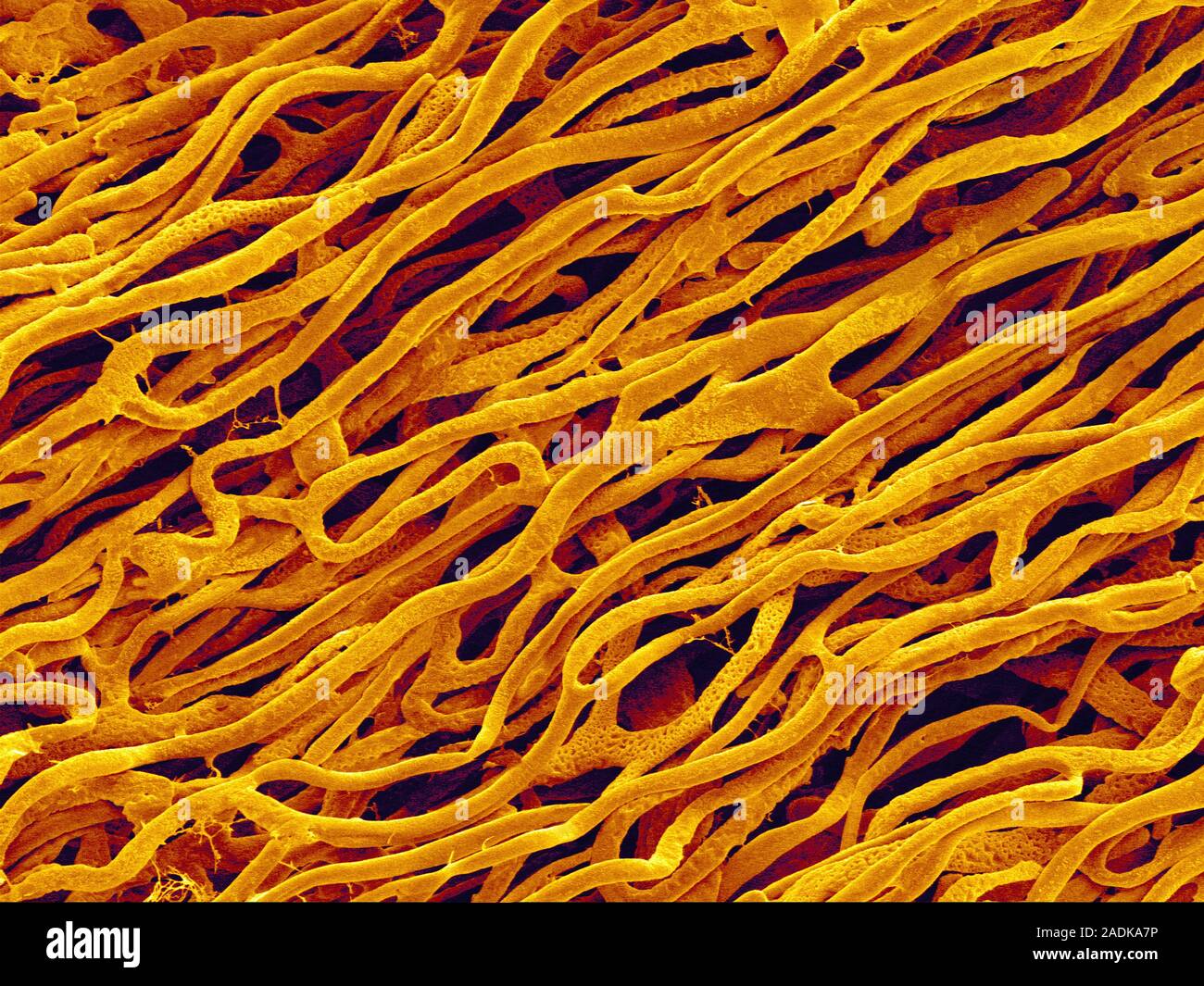 Blood vessels from cardiac muscle. Coloured scanning electron ...