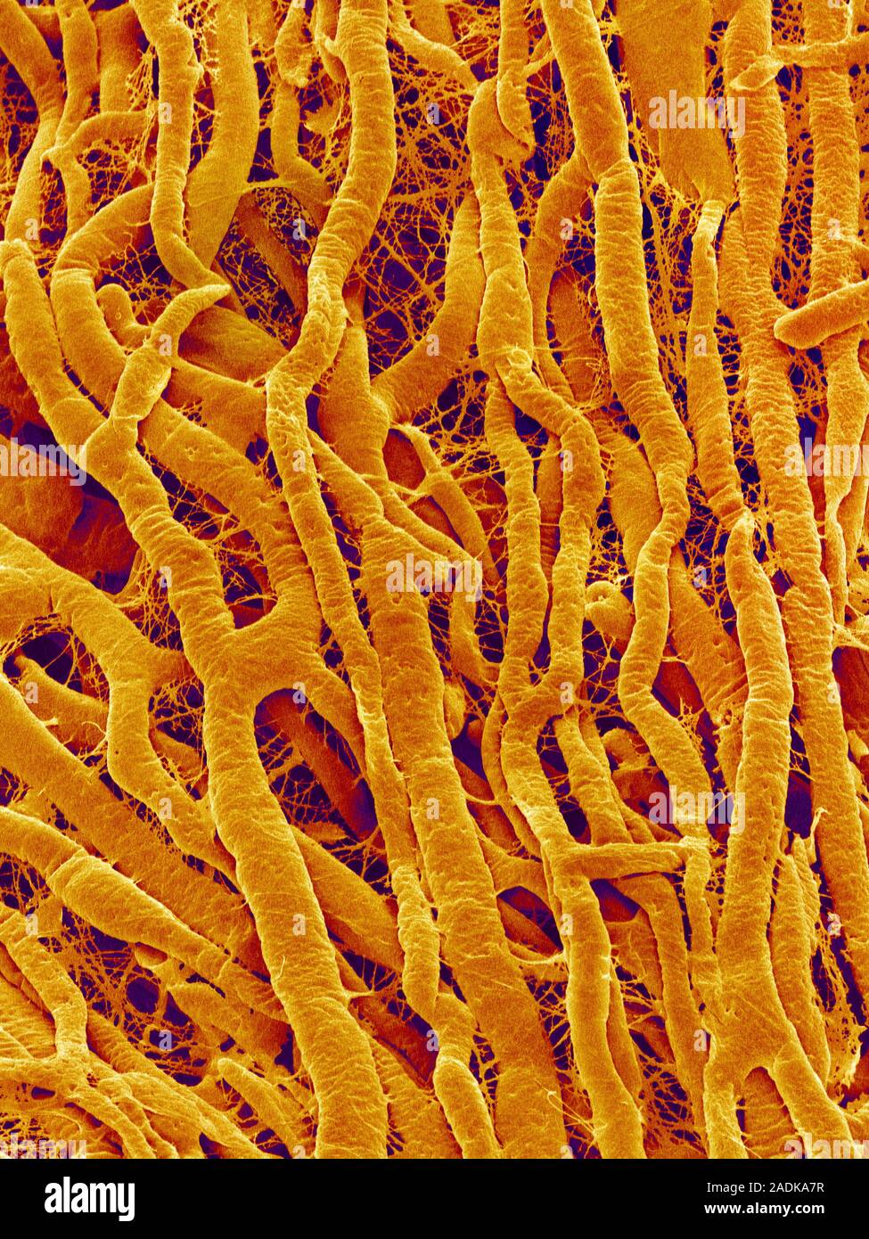 Blood vessels from cardiac muscle. Coloured scanning electron ...