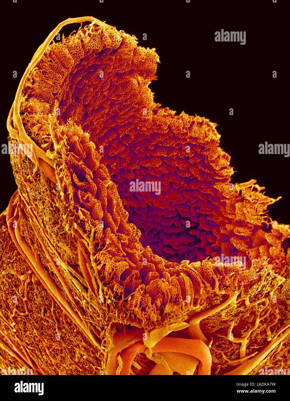 Blood vessels of the small intestine, coloured scanning electron ...