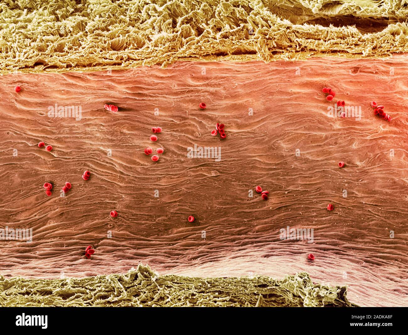 Ovarian blood vessel. Coloured scanning electron micrograph (SEM) of a ...