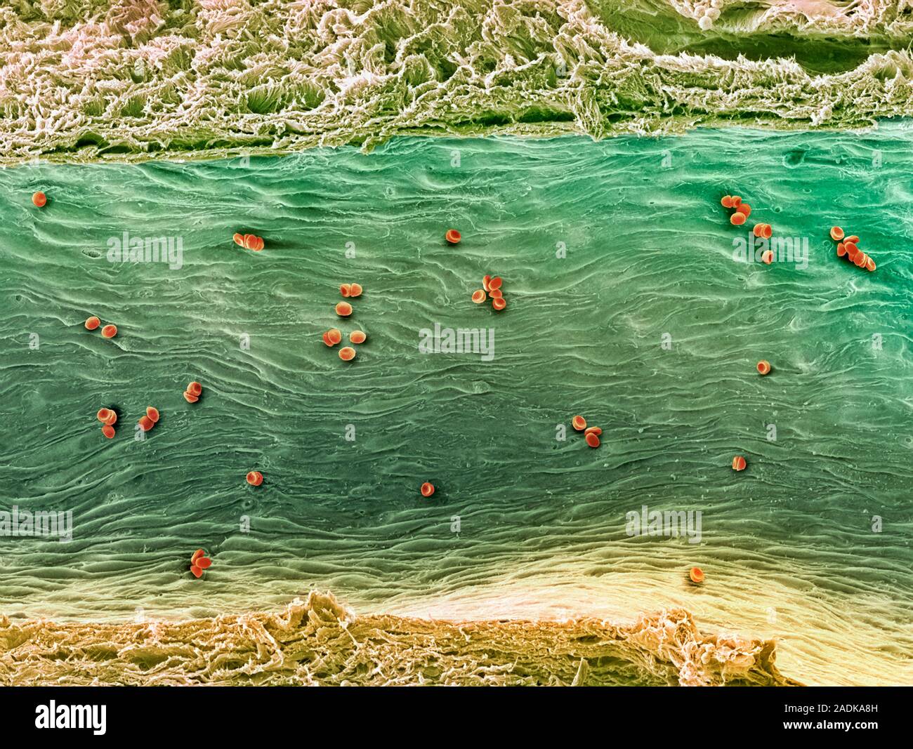 Ovarian blood vessel. Coloured scanning electron micrograph (SEM) of a ...