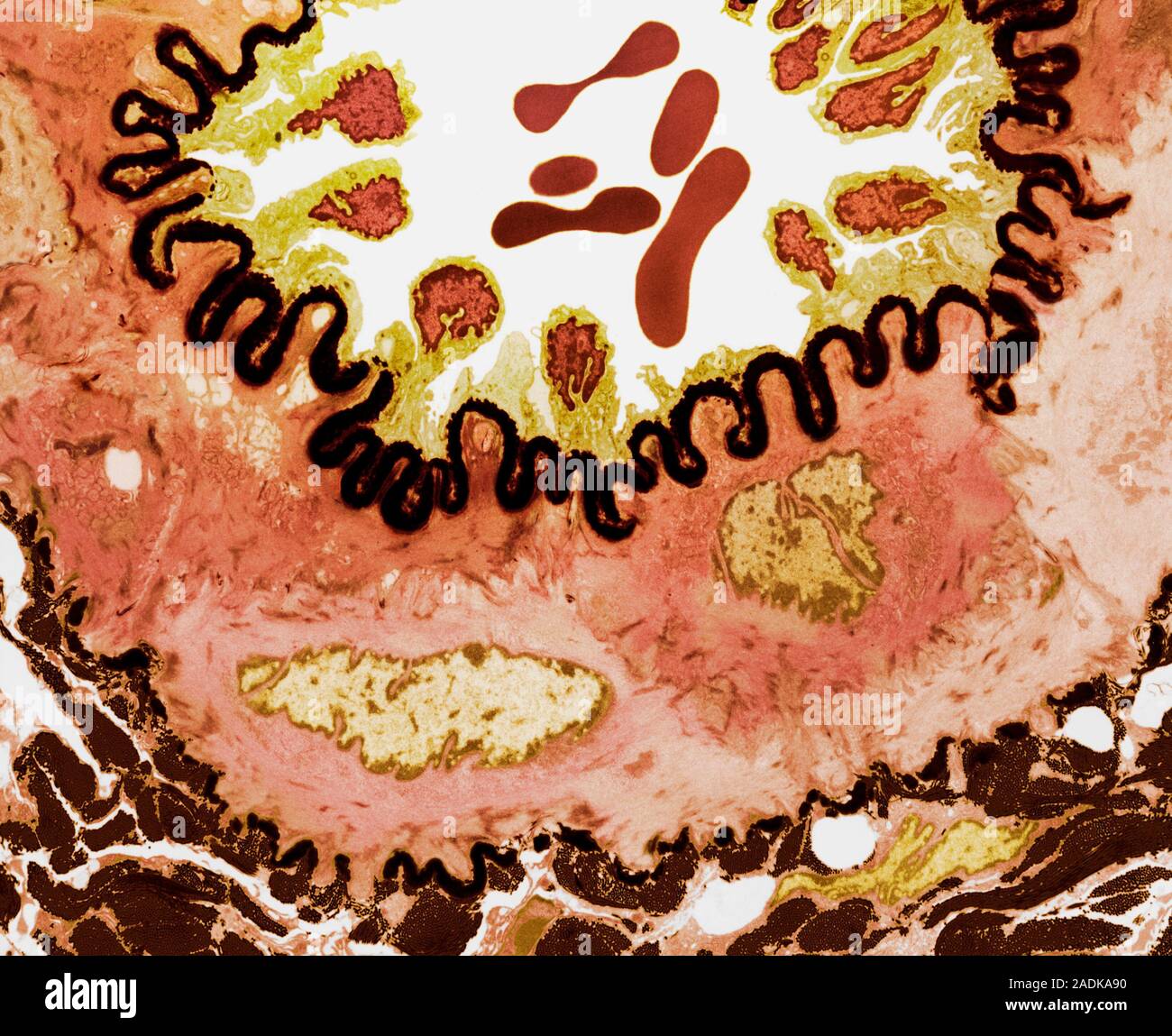 Contracted elastic artery. Coloured transmission electron micrograph ...