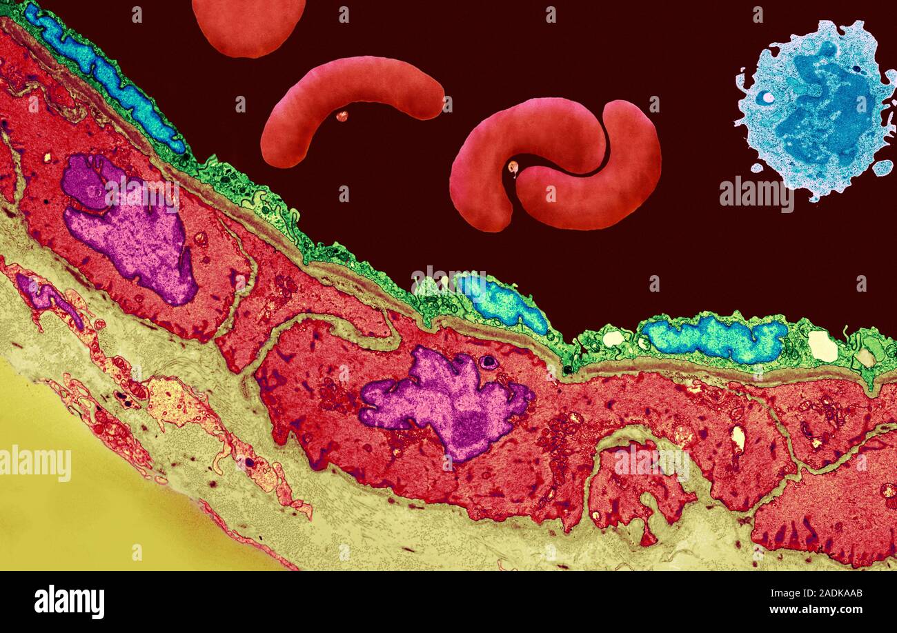 Coronary artery. Coloured transmission electron micrograph (TEM) of a ...