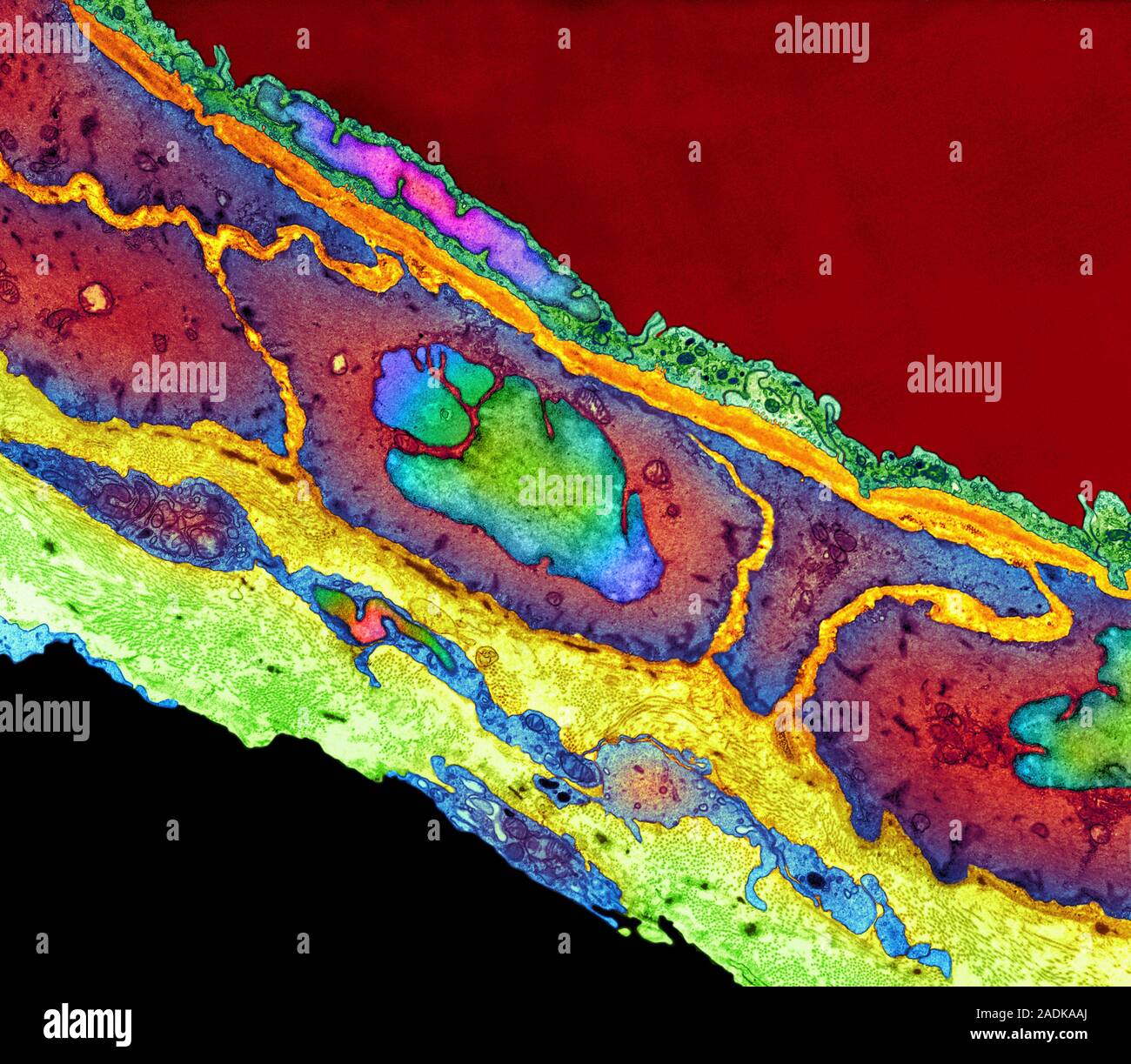 Coronary artery. Coloured transmission electron micrograph (TEM) of a ...