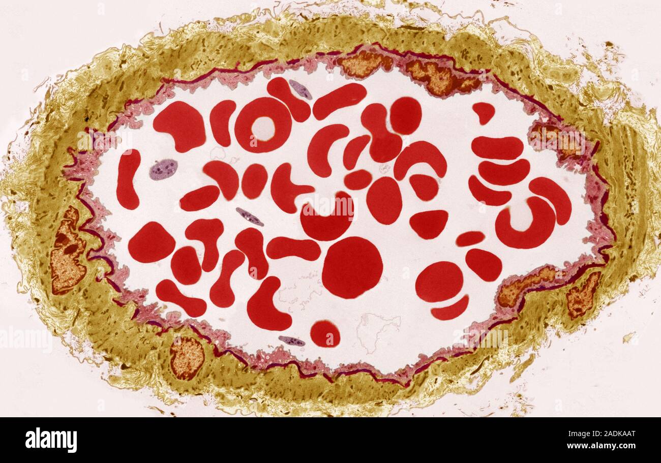 Artery. Coloured transmission electron micrograph (TEM) of a transverse ...