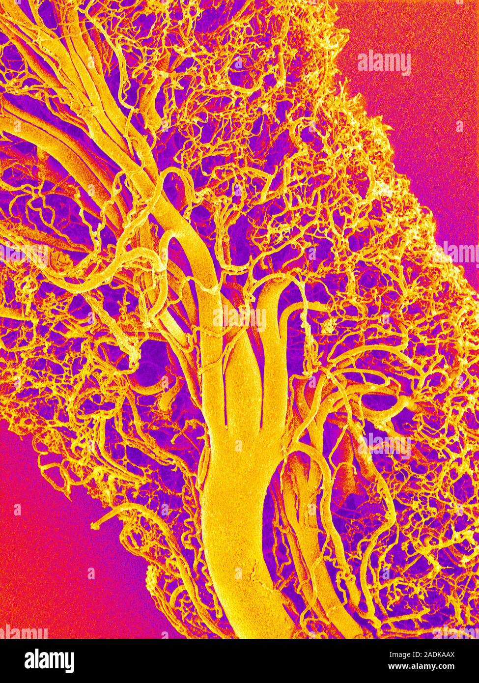 Blood vessels. Coloured scanning electron micrograph (SEM) of a resin ...