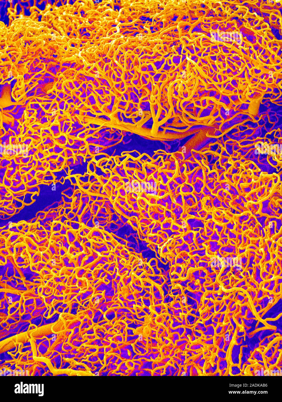 Pancreatic blood vessels. Coloured scanning electron micrograph (SEM ...