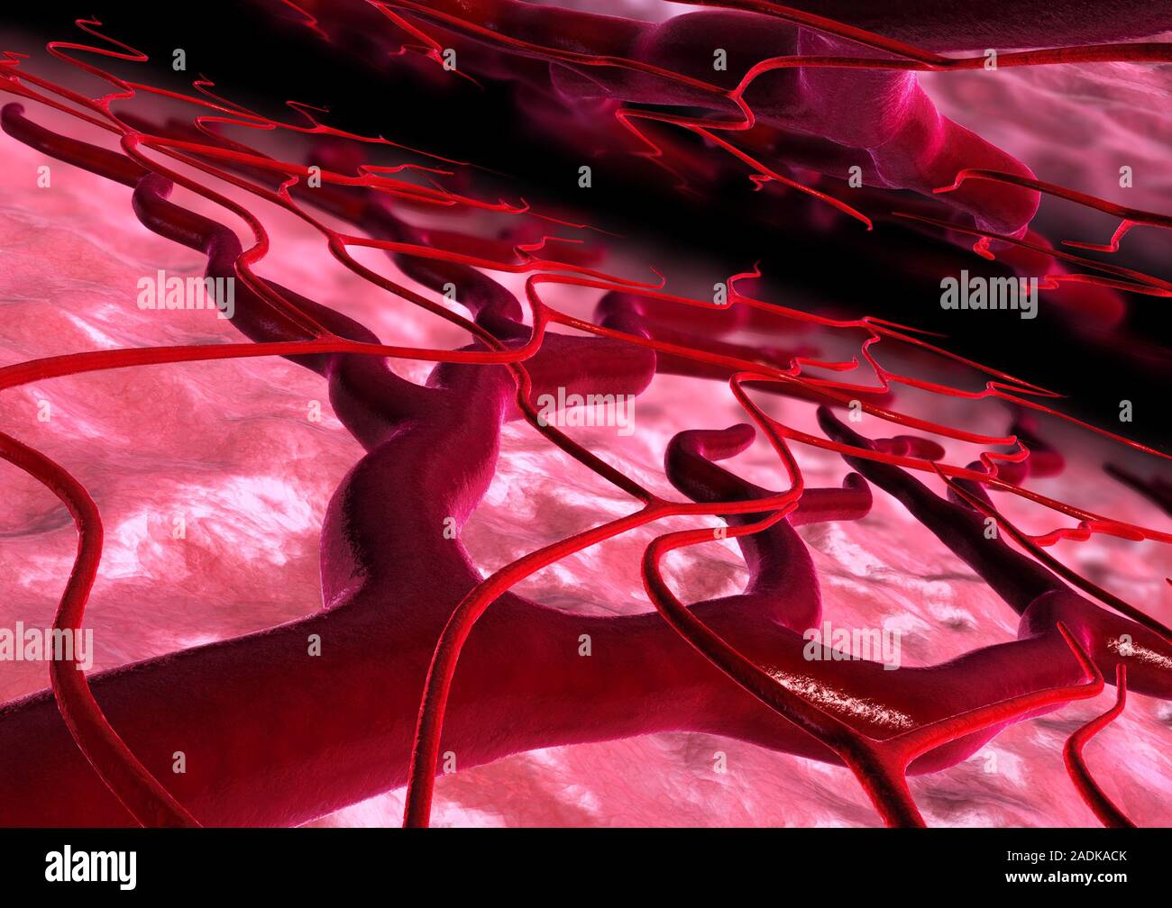 Blood vessel dilation. Computer artwork of blood vessel dilation ...