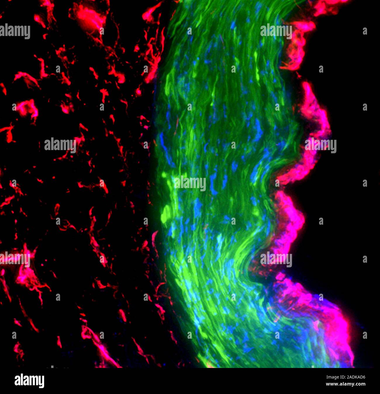 Artery tissue layers, fluorescence deconvolution micrograph ...