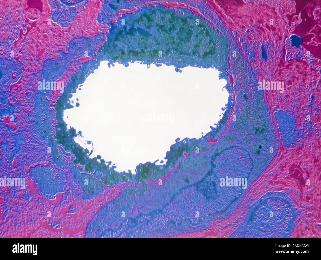 Capillary cross-section, coloured transmission electron micrograph (TEM). The lumen (white) is ...