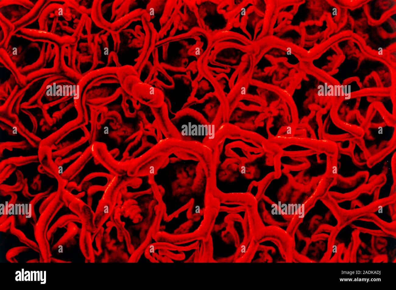 Artwork based on a scanning electron micrograph (SEM) of a ...