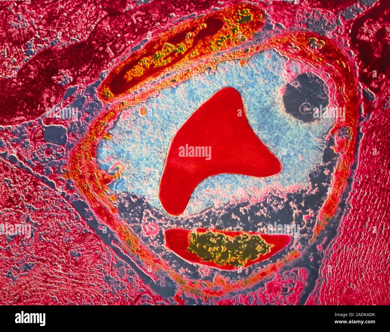 False-colour transmission electron micrograph (TEM) of a transverse ...