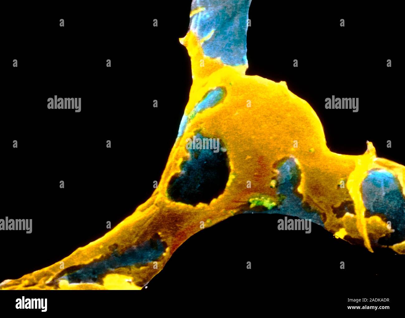 Pericyte. Coloured scanning electron micrograph showing a pericyte ...