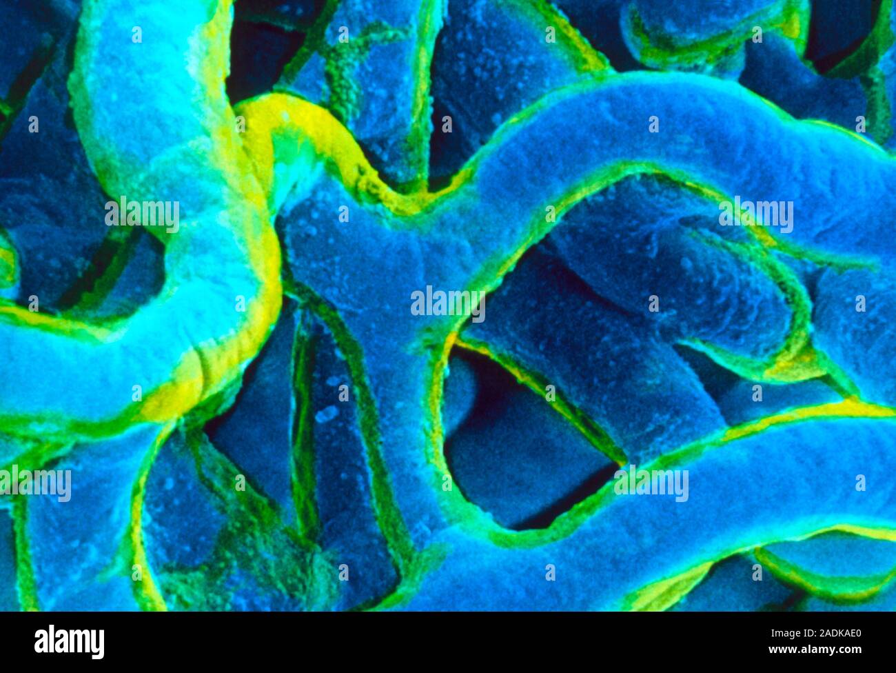 Blood capillaries. Coloured scanning electron micrograph of a network ...