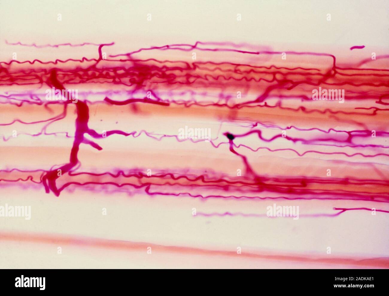 Capillary blood supply. Light micrograph of the capillary blood supply ...