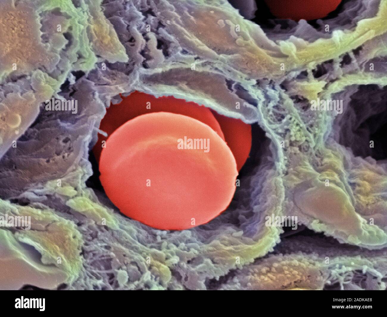 Capillary. Coloured scanning electron micrograph (SEM) of a section ...