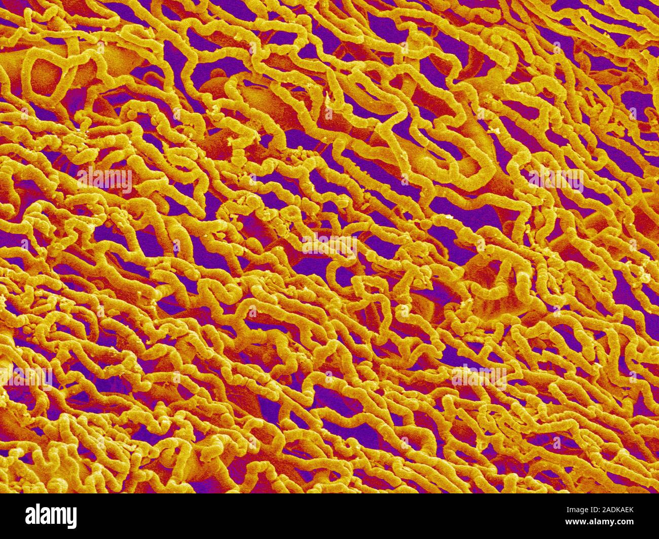 Capillaries. Coloured scanning electron micrograph (SEM) of a resin ...