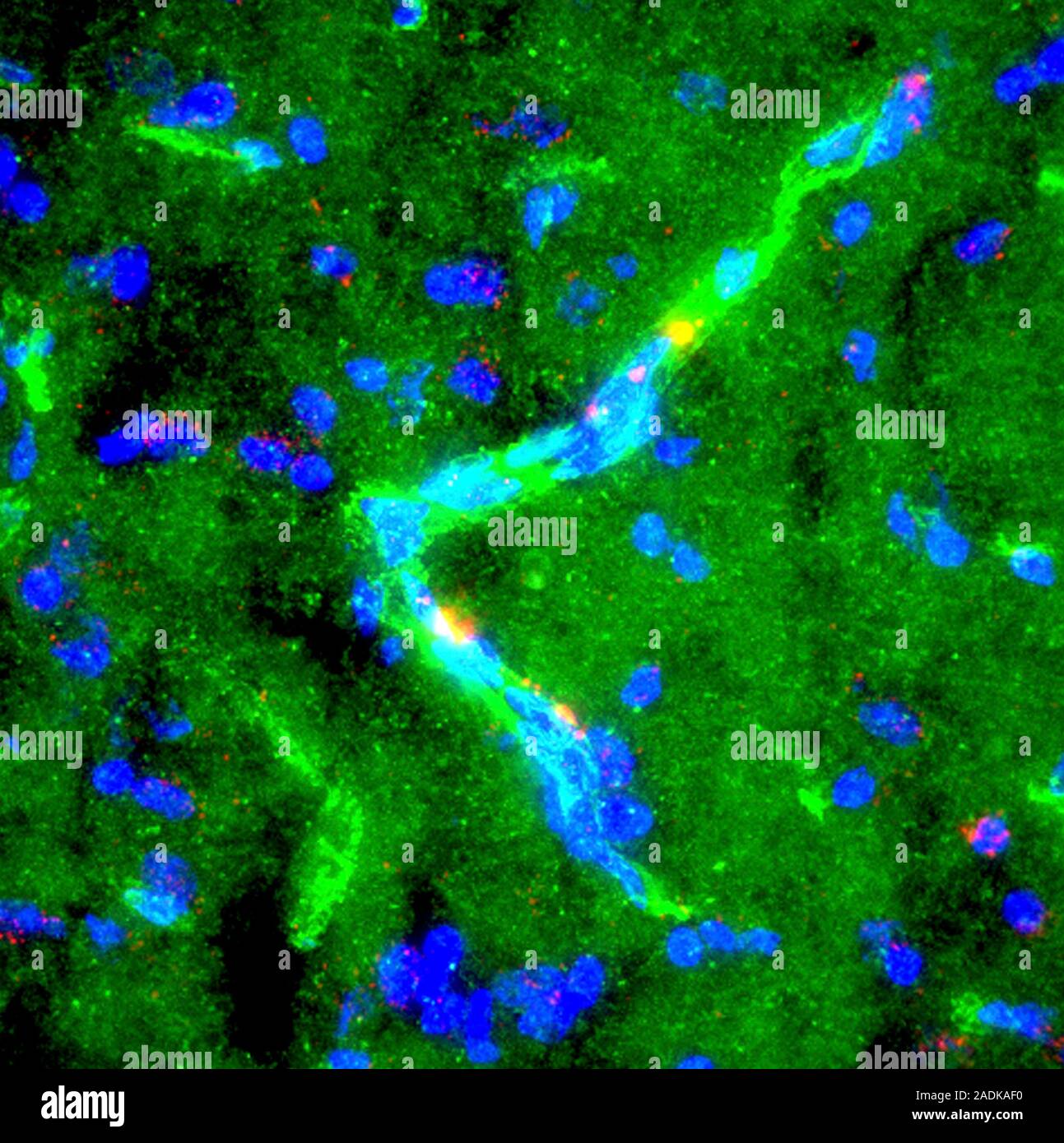 Brain blood vessels, fluorescence deconvolution micrograph. Fluorescent ...