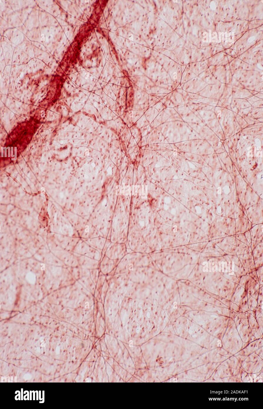 Intestinal capillaries. Light micrograph of the fine network of ...