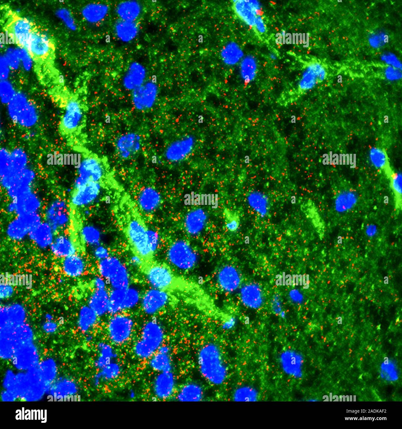 Brain blood vessels, fluorescence deconvolution micrograph. Fluorescent ...