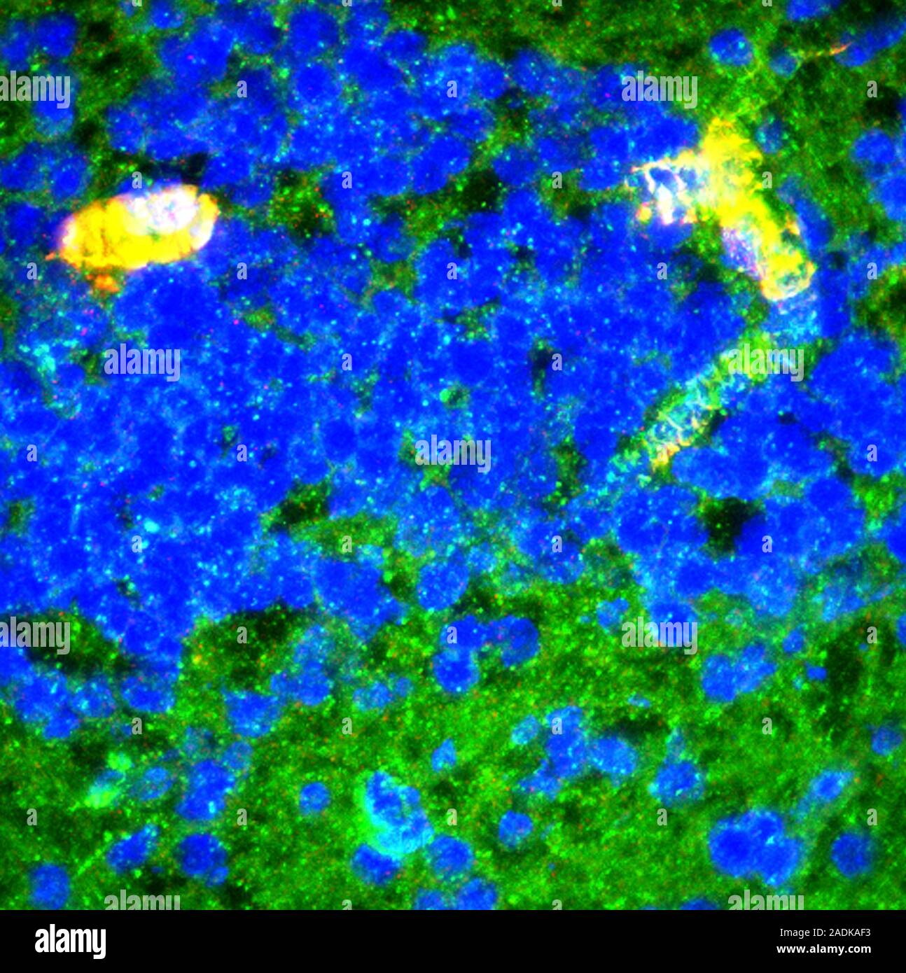 Brain blood vessels, fluorescence deconvolution micrograph. Fluorescent ...