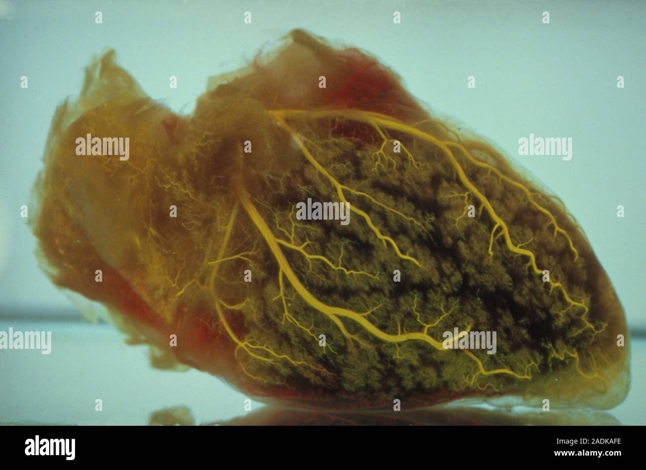 Specimen of the human heart, photographed in lateral view and specially ...