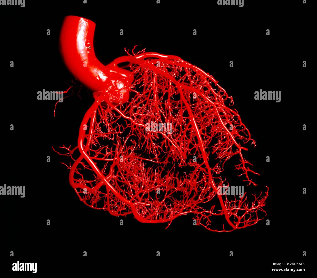 Resin cast of the coronary arteries of the heart in front view, showing ...