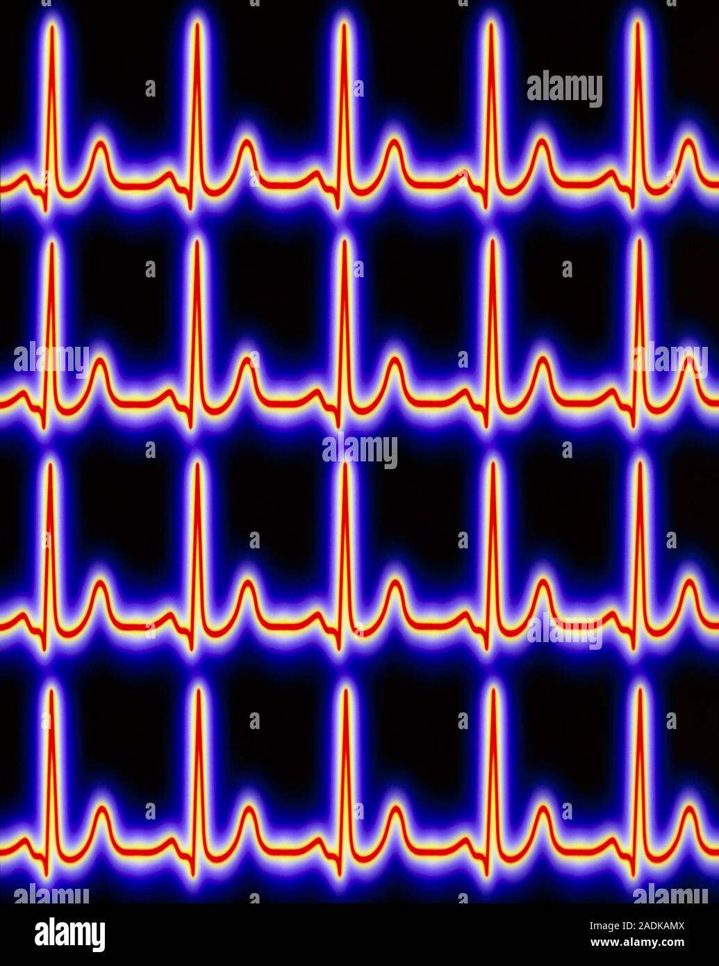 Healthy ECG heart traces. Computer-enhanced image of many ...