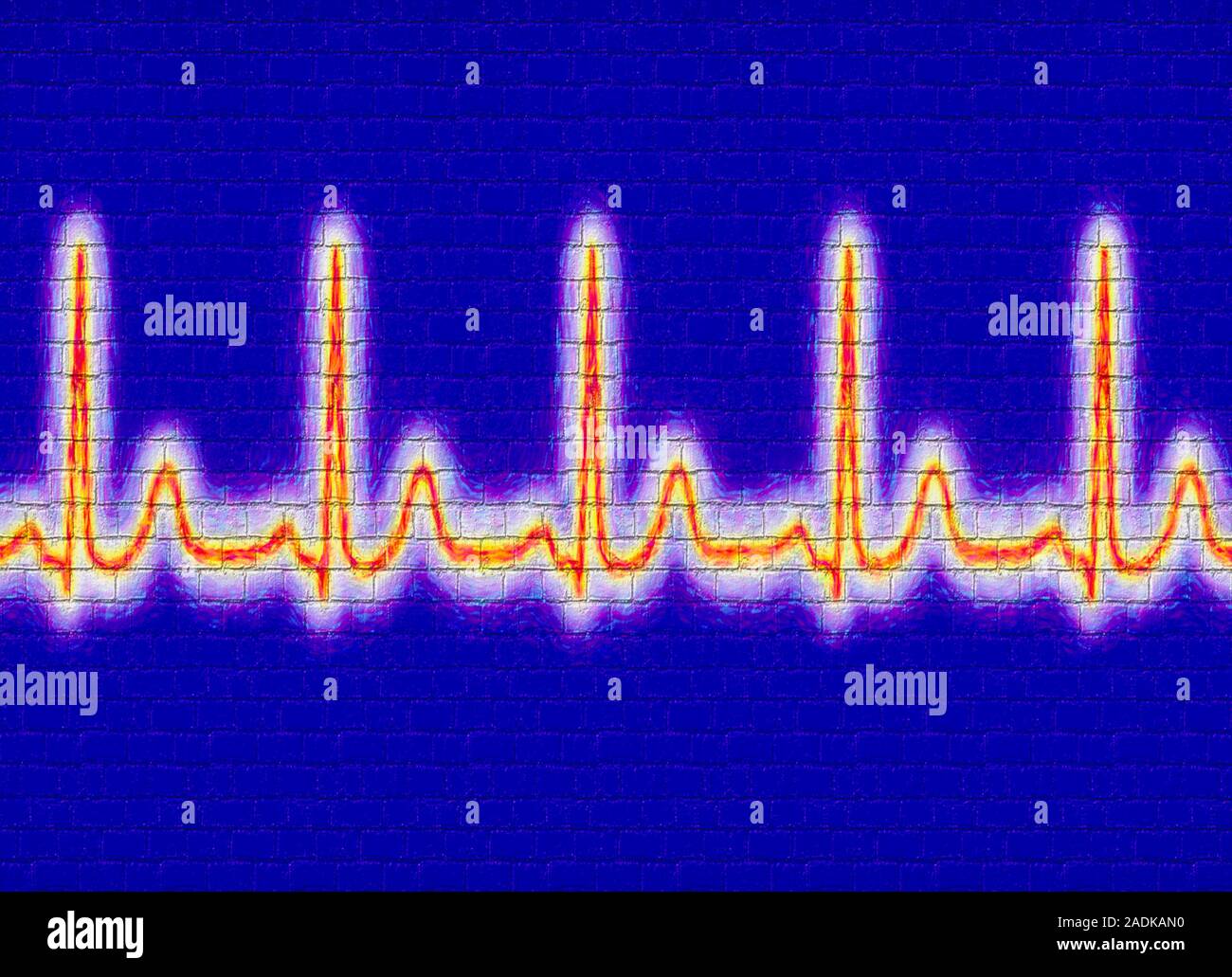 Healthy ECG heart trace. Computer-enhanced image of an ...