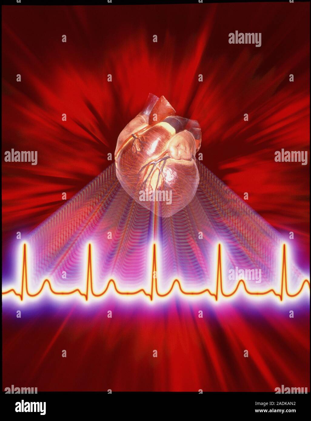 Healthy ECG heart trace. Computer-enhanced image of an ...
