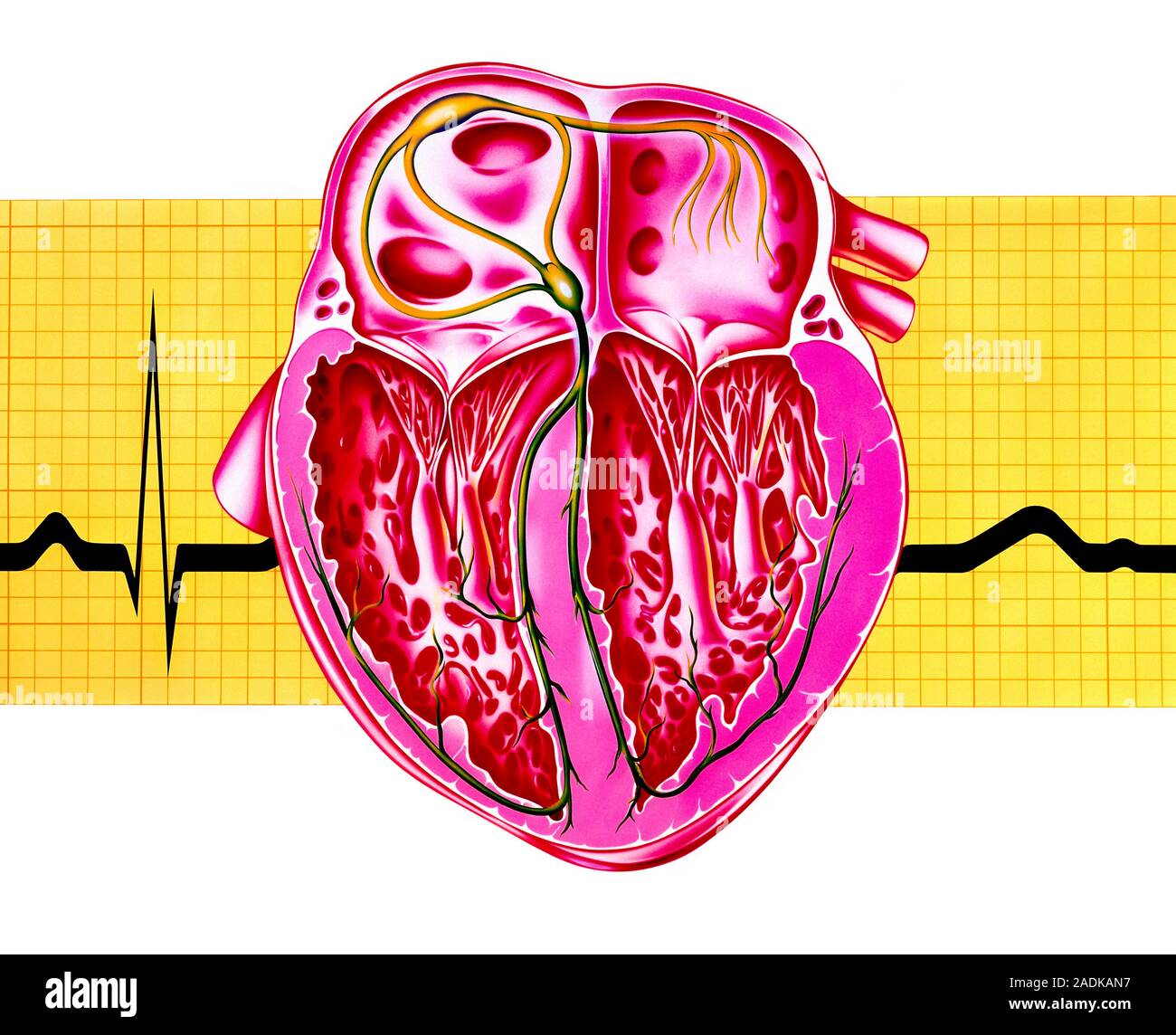 Heart nerve conduction. Illustration of a section through a human heart ...