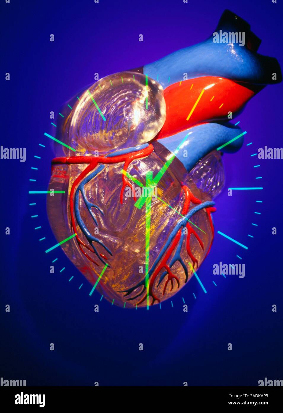 Human heart. Conceptual image of a clock face on a model of a human ...
