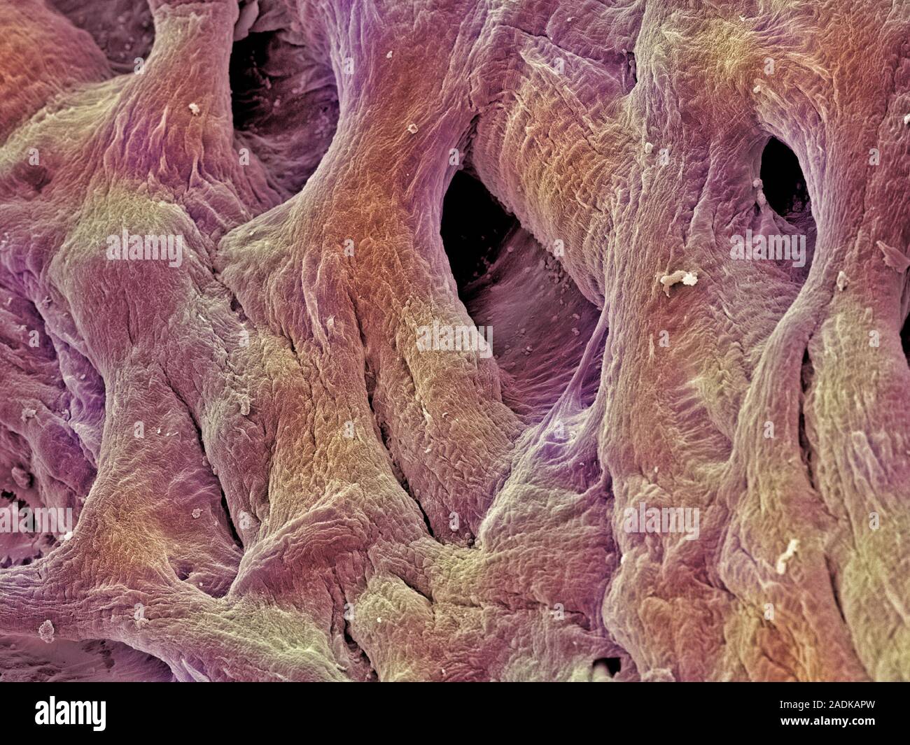 Heart valve tendons. Coloured scanning electron micrograph (SEM) of the ...