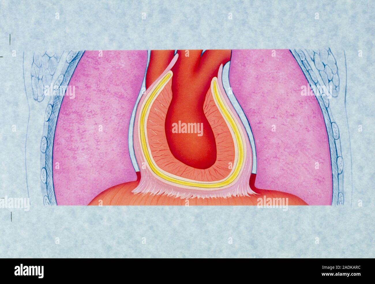 Heart pericardium. Artwork of a section through the pericardium, a ...