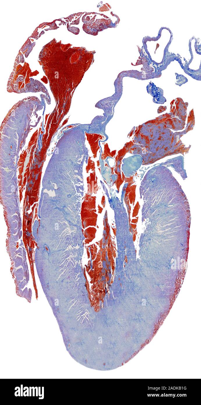 Dissected heart. Light micrograph of a section through a whole heart ...