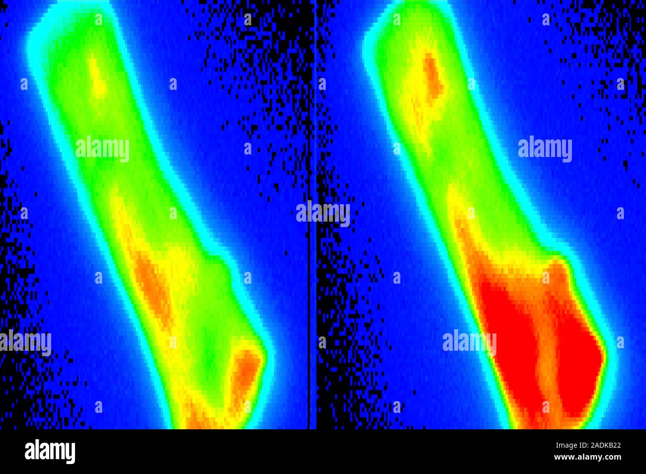 Calcium in heart cell, fluorescence deconvolution micrograph. A ...