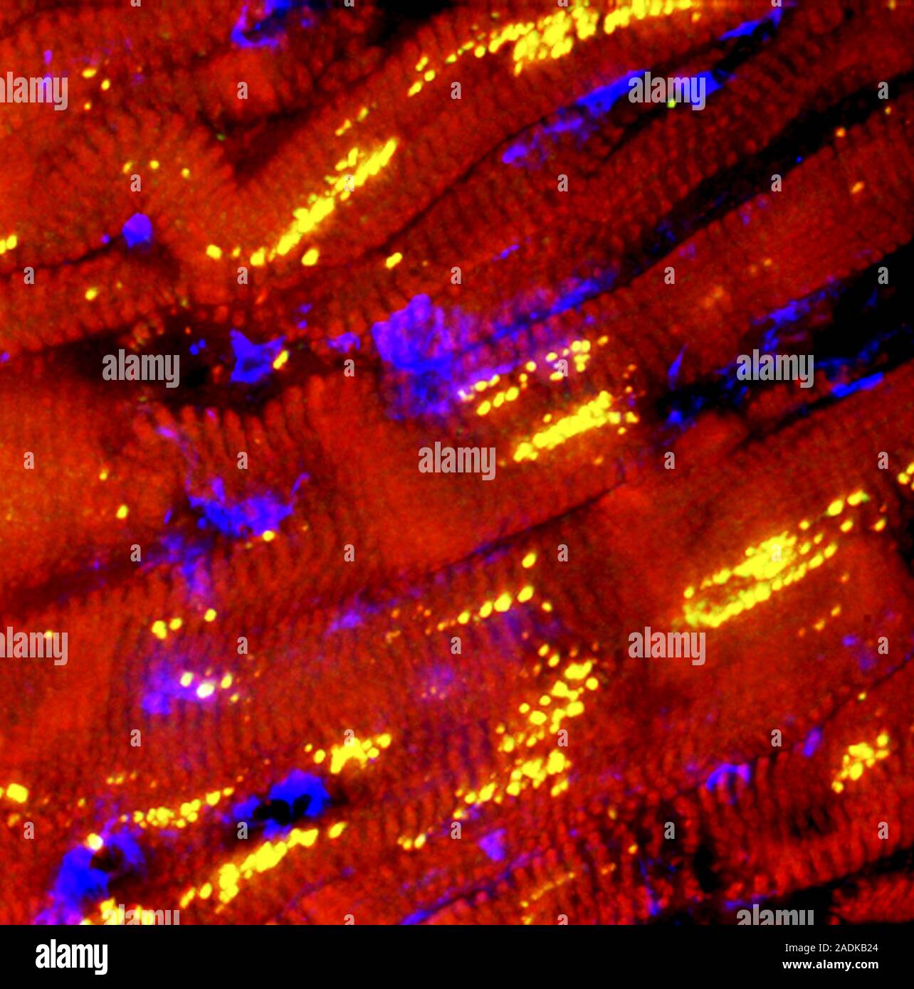 Cardiac muscle fibres, fluorescence deconvolution micrograph ...