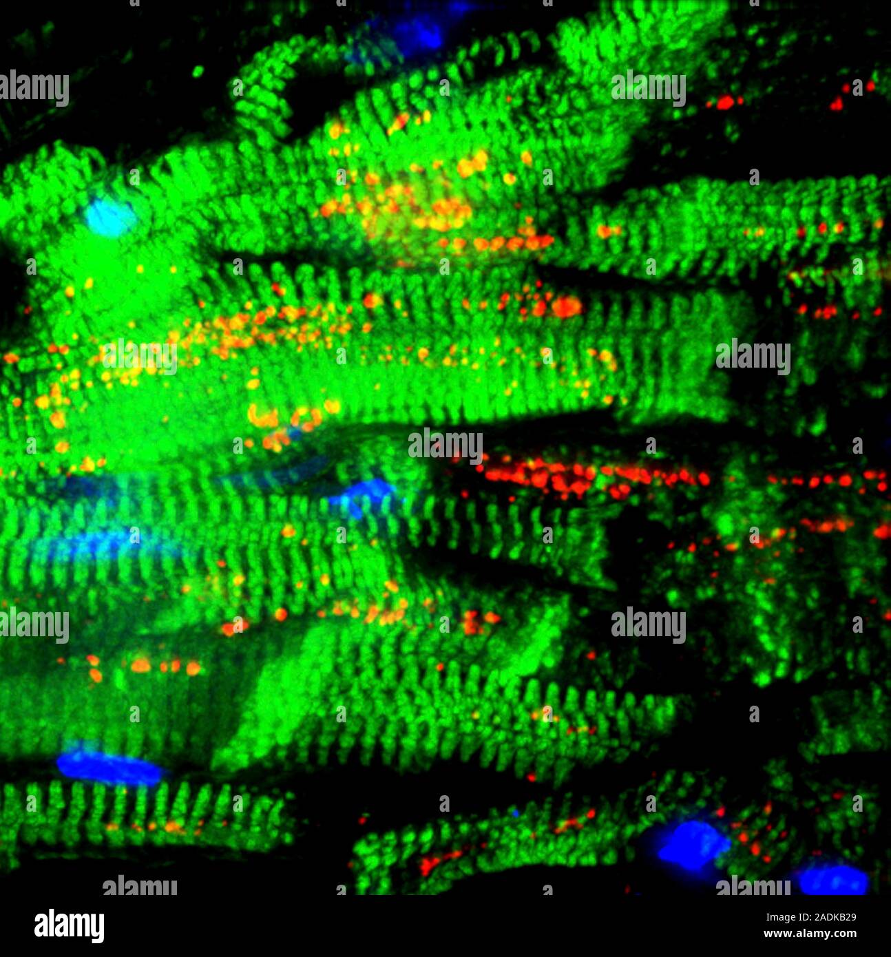 Cardiac muscle fibres, fluorescence deconvolution micrograph ...