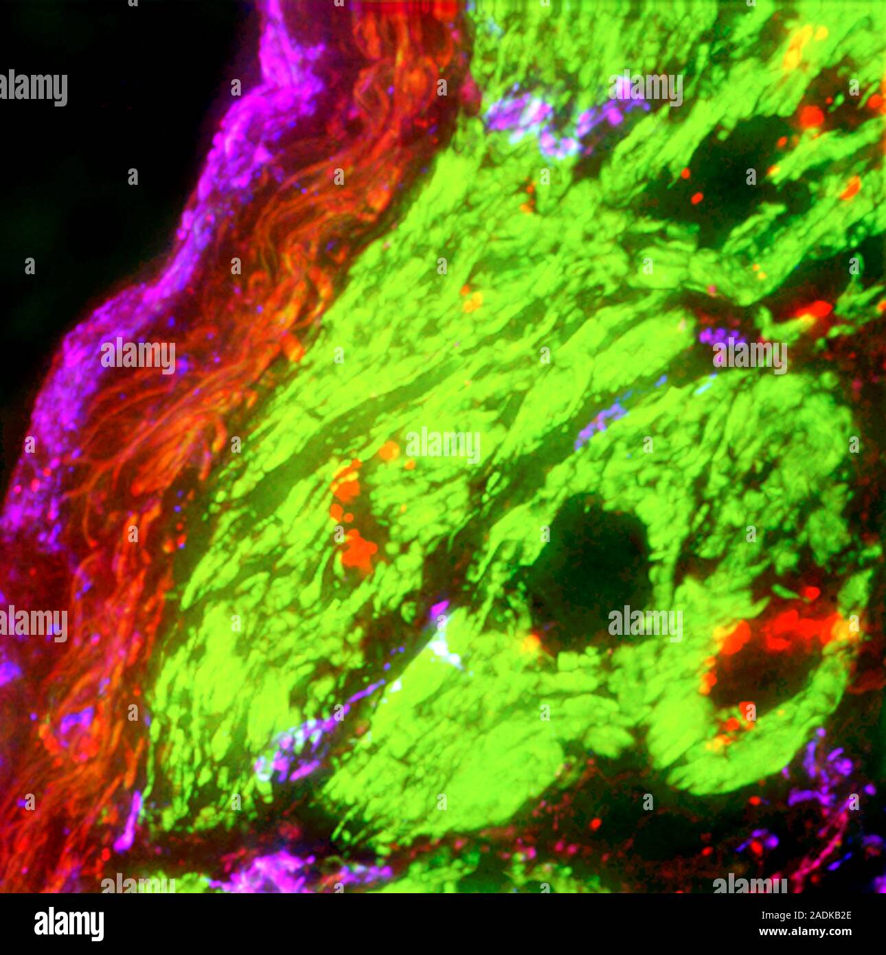 Epicardium tissue, fluorescence deconvolution micrograph. Fluorescent ...