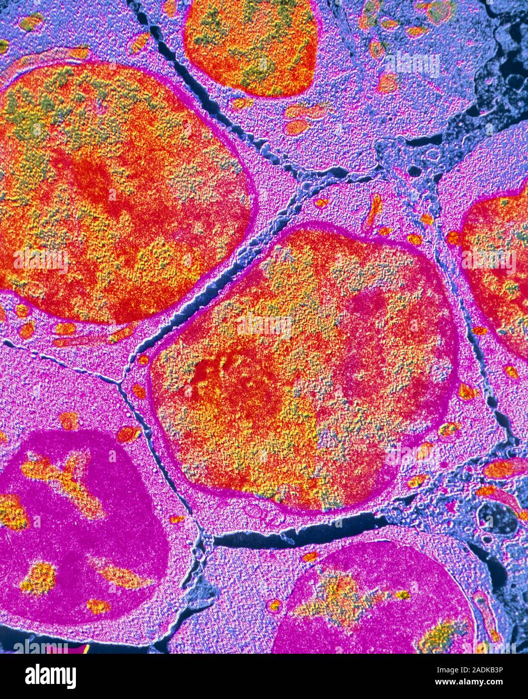 False-colour transmission electron micrograph of erythroblasts ...