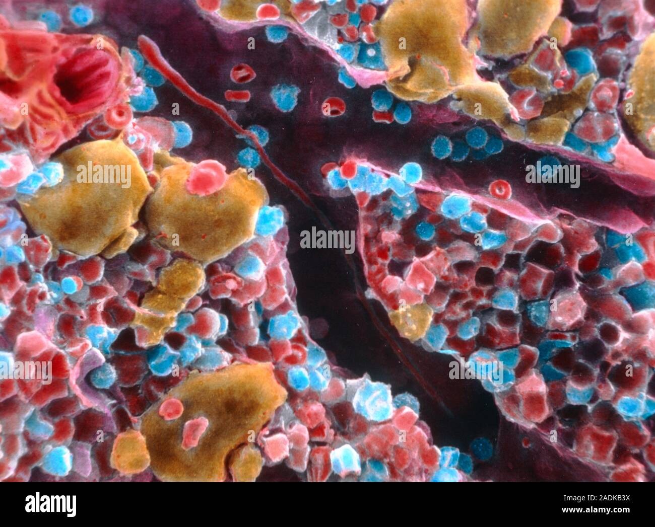Bone marrow. Coloured Scanning Electron Micrograph (SEM) of cells ...