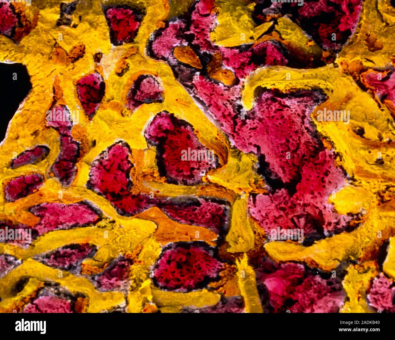 Bone marrow. Coloured Scanning Electron Micrograph (SEM) of spongy bone ...