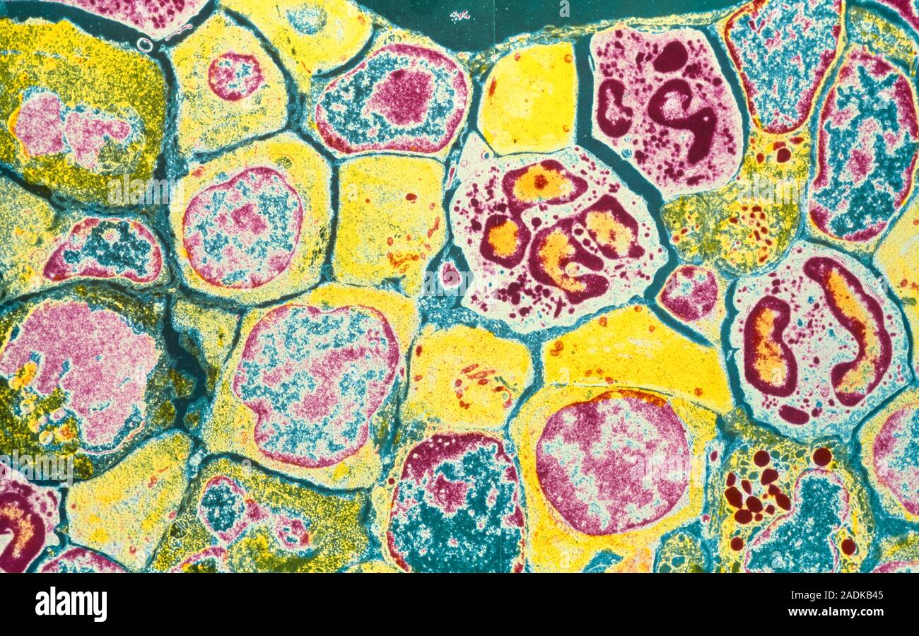 Bone marrow. Coloured transmission electron micrograph (TEM) of various ...