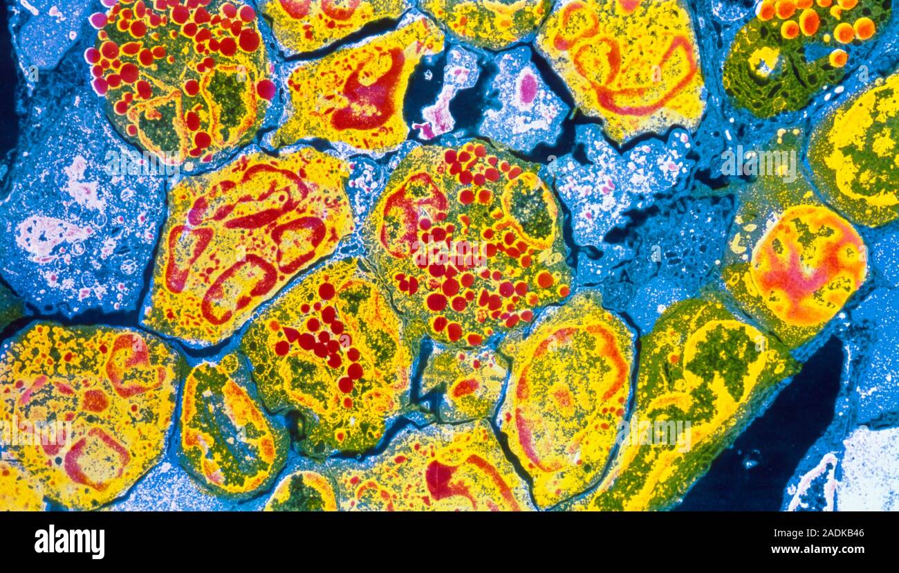 Bone marrow. Coloured transmission electron micrograph (TEM) of various ...