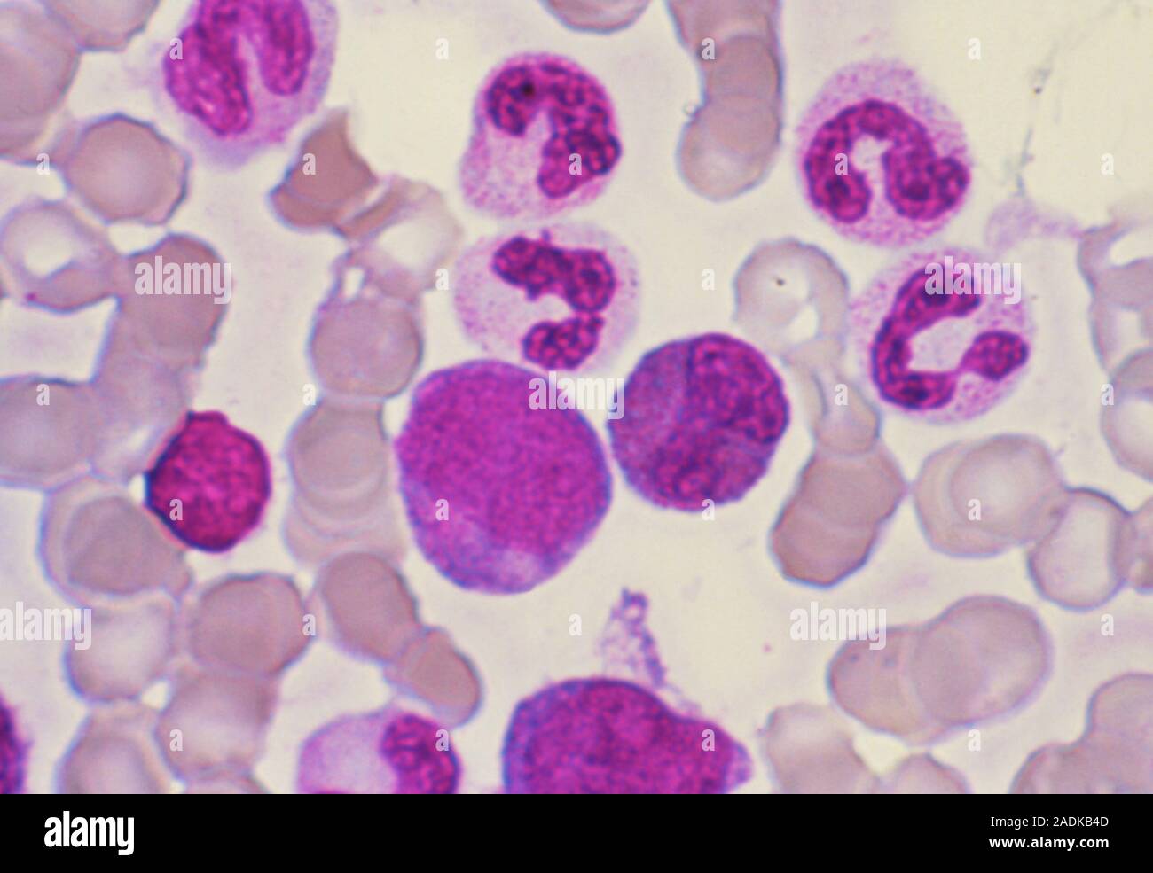 Bone marrow. Light micrograph of a bone marrow smear showing red and ... Bone marrow. Light micrograph of a bone marrow smear showing red and ...