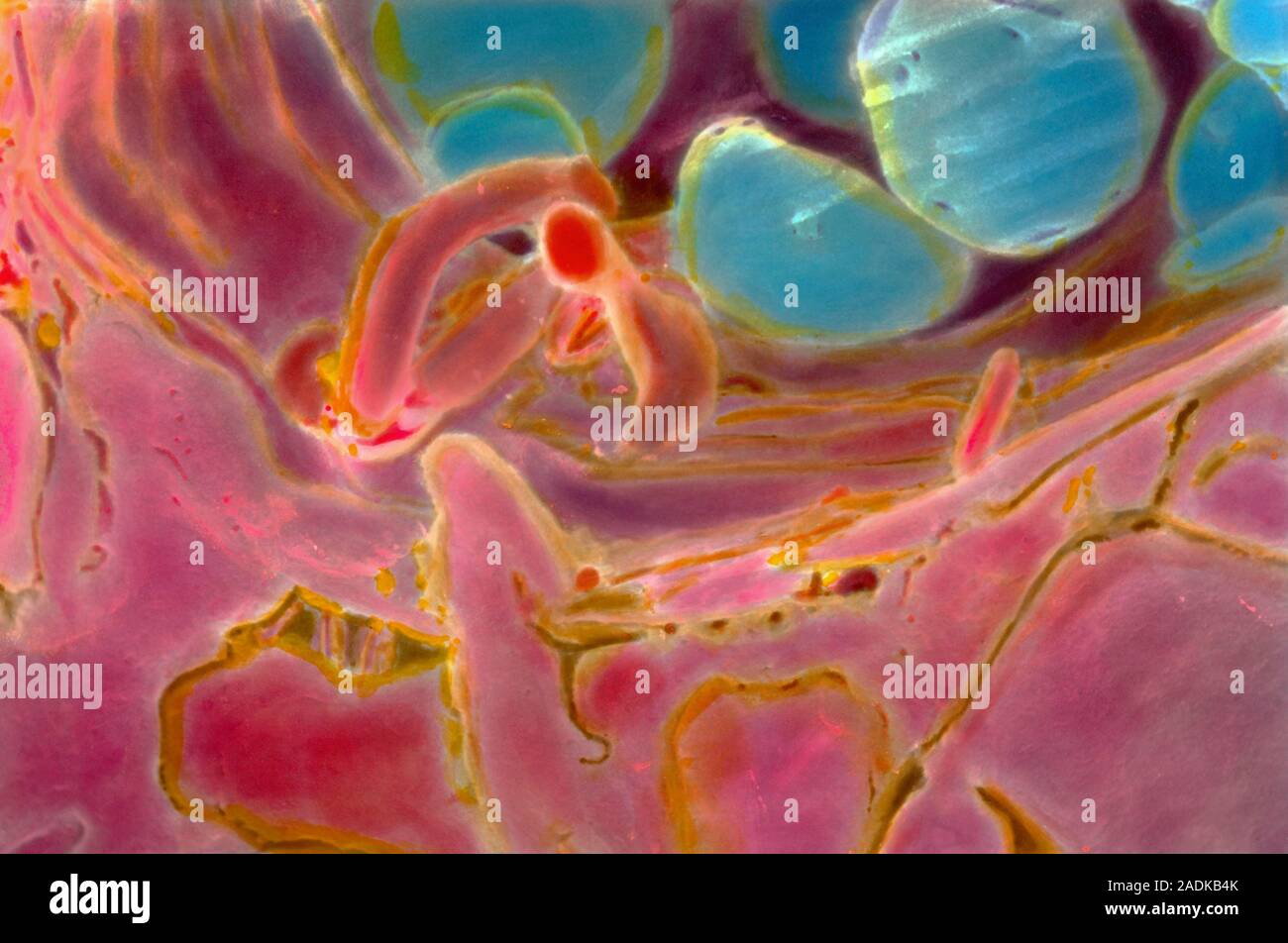 Megakaryocytes. Coloured scanning electron micrograph (SEM) of ...